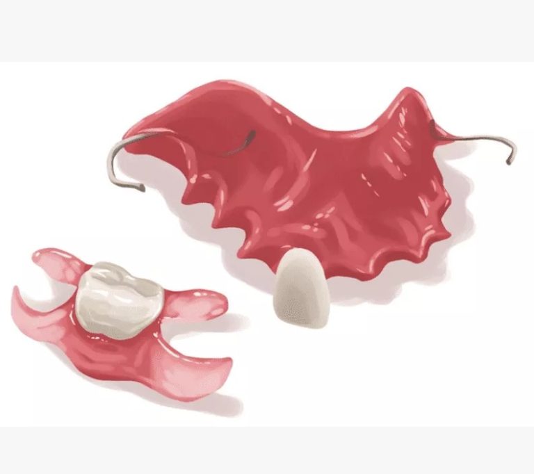 Flipper Dental - Dentalfantasy